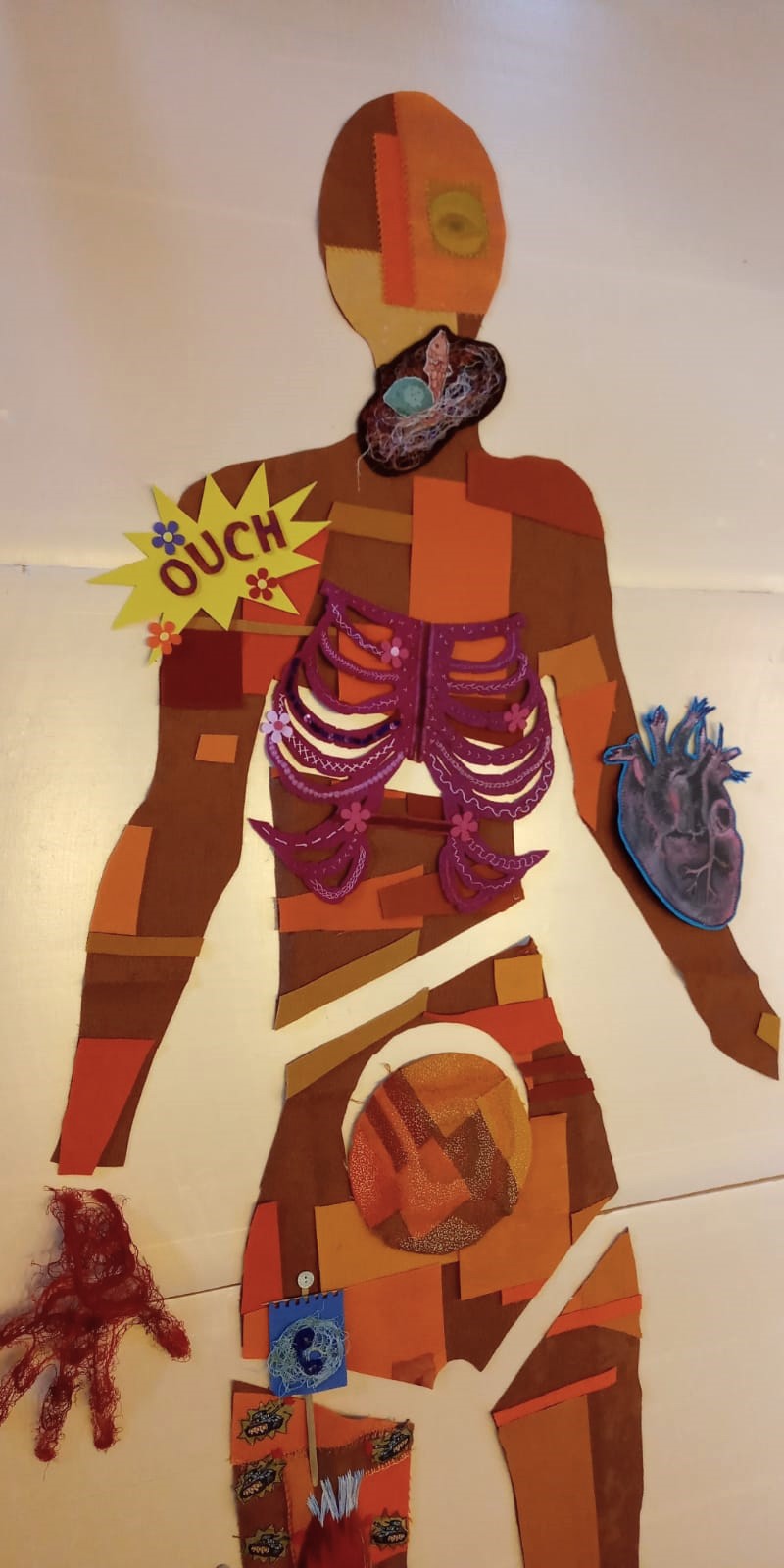 Picking up the pieces after my vasculitis diagnosis