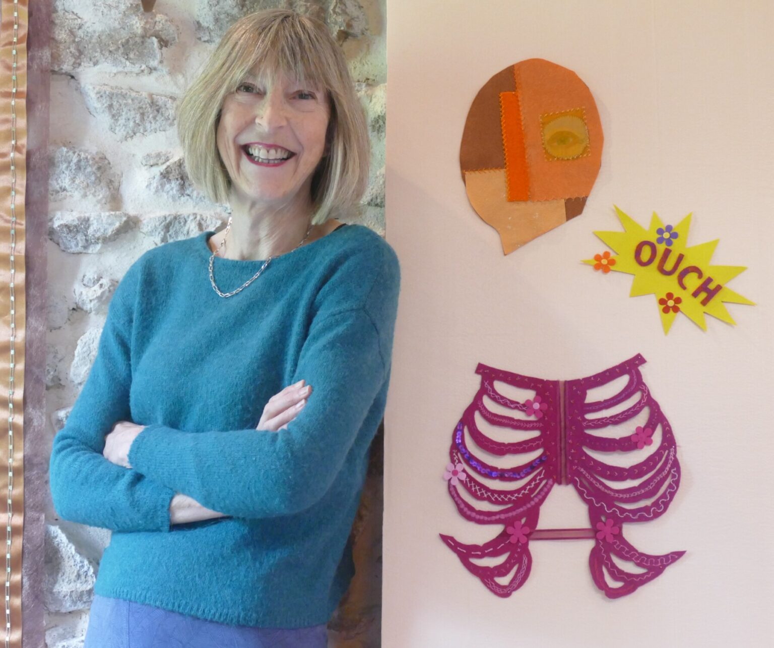 Picking up the pieces after my vasculitis diagnosis